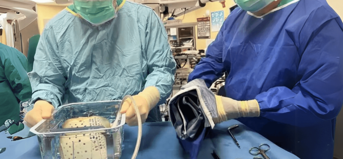 Aeson Artificial Heart Implanted at Sheba Medical Center