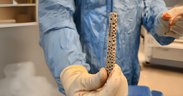 Sheba Performs Israel’s First 3D Printed Biocompatible Bone Implant Surgery